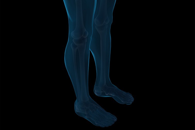 FDA-approved clinical trial tests stem cells to heal wounds - Sanford ...